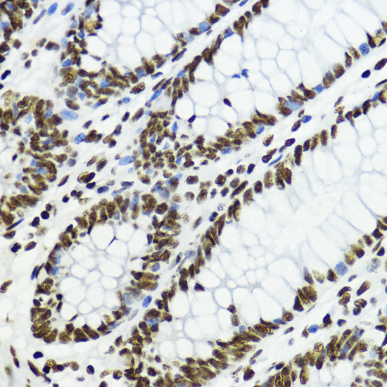 Histone H3K27ac (Acetyl H3K27) Polyclonal Antibody | EpiGentek