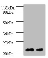 ORM2 Polyclonal Antibody | EpigenTek