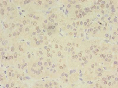ZDHHC4 Polyclonal Antibody | EpiGentek