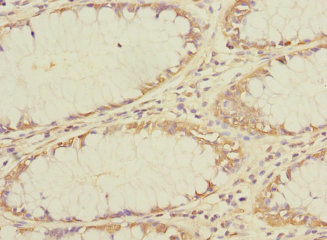 TMEM209 Polyclonal Antibody | EpigenTek