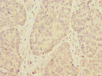 TMEM209 Polyclonal Antibody | EpigenTek