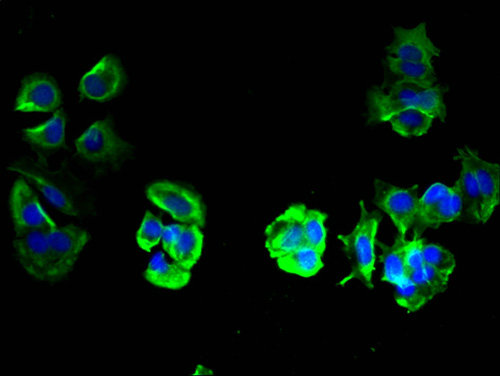 TMEM209 Polyclonal Antibody | EpigenTek