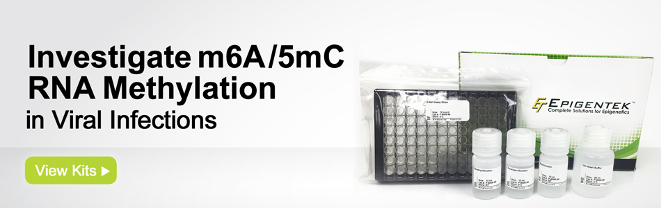 Global m6A/5mC RNA Quantification Kits | EpigenTek